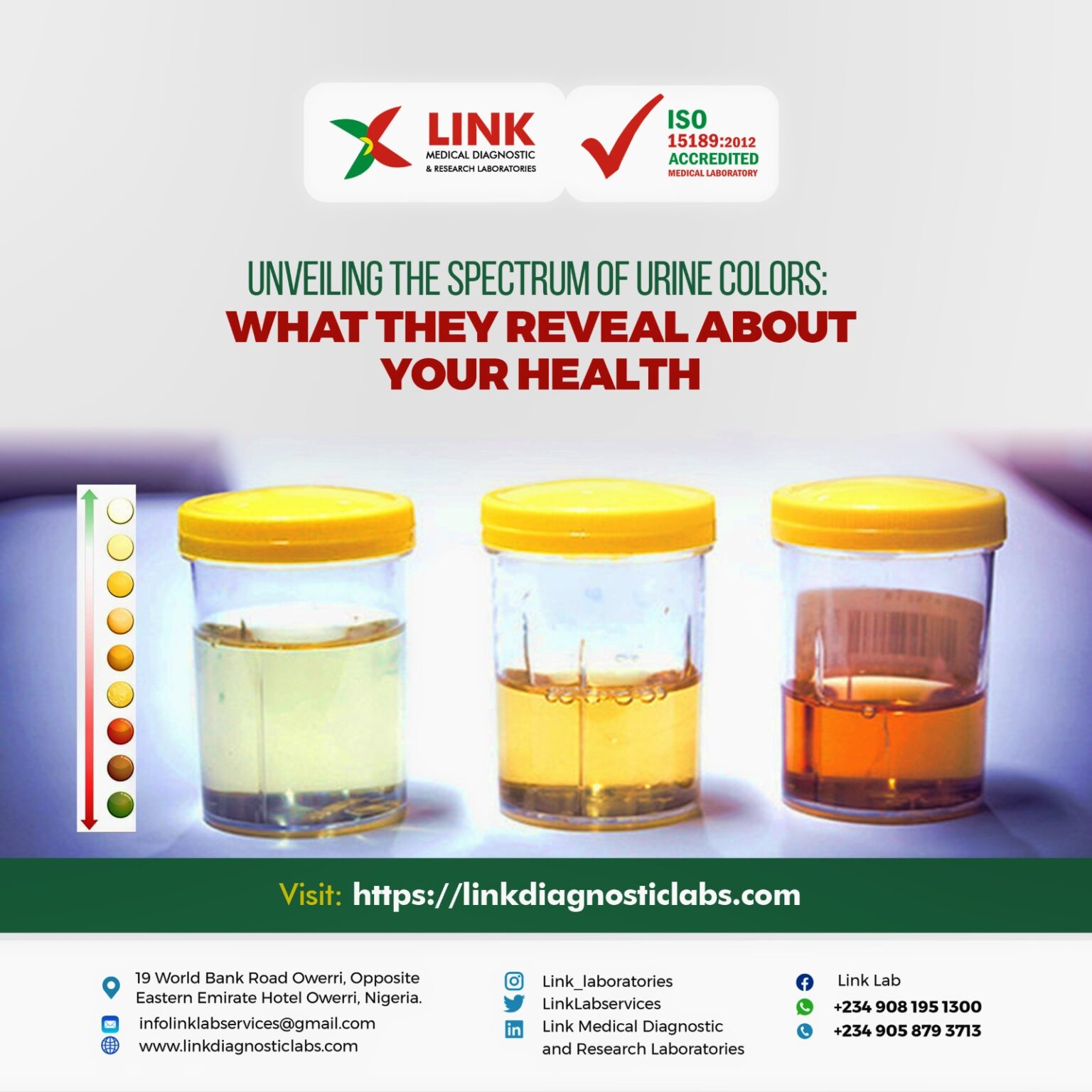 Spectrum of Urine Colors and Your Health